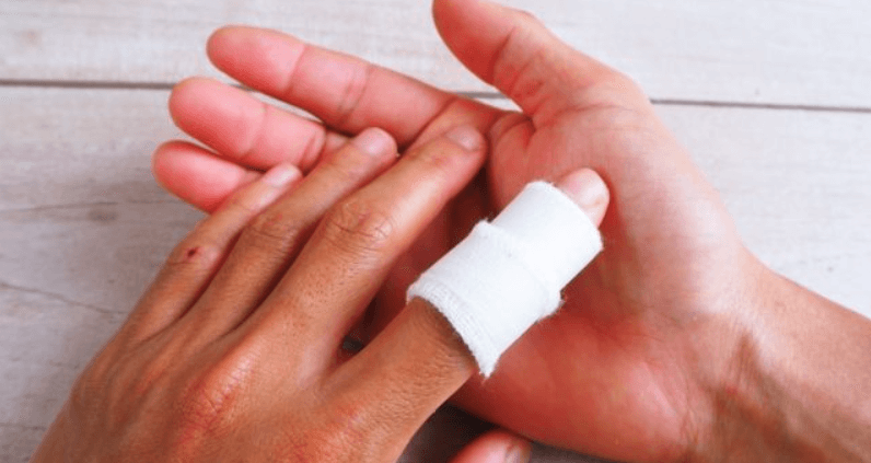 Pravilno oskrbite zagnojene rane na prstu! | Hills.si